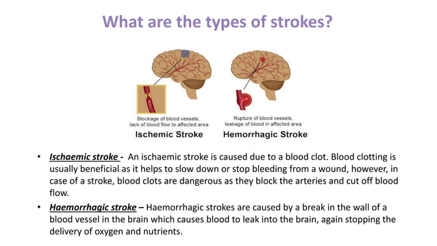 Types of strokes | PPTX | Blood Disorders | Diseases and Conditions