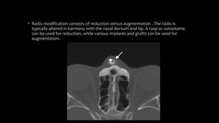 Types of surgery rhinoplasty | PPT