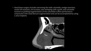 Types of surgery rhinoplasty | PPT