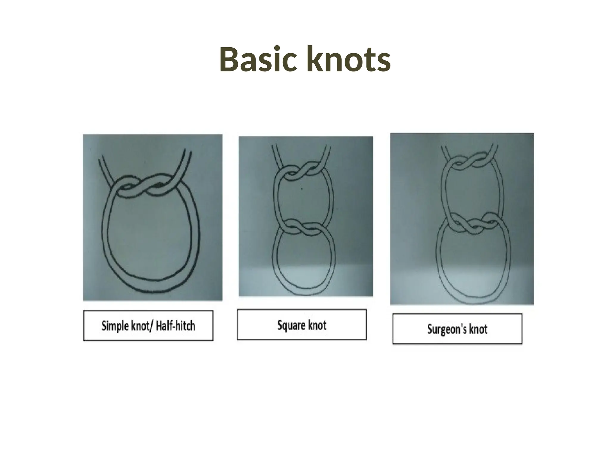 Types of suture used in different region of.pptx
