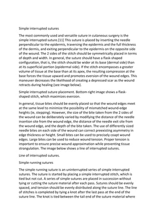 Types of suturing word document | DOCX