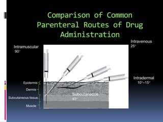 Types of Syringes and Needles | PPTX