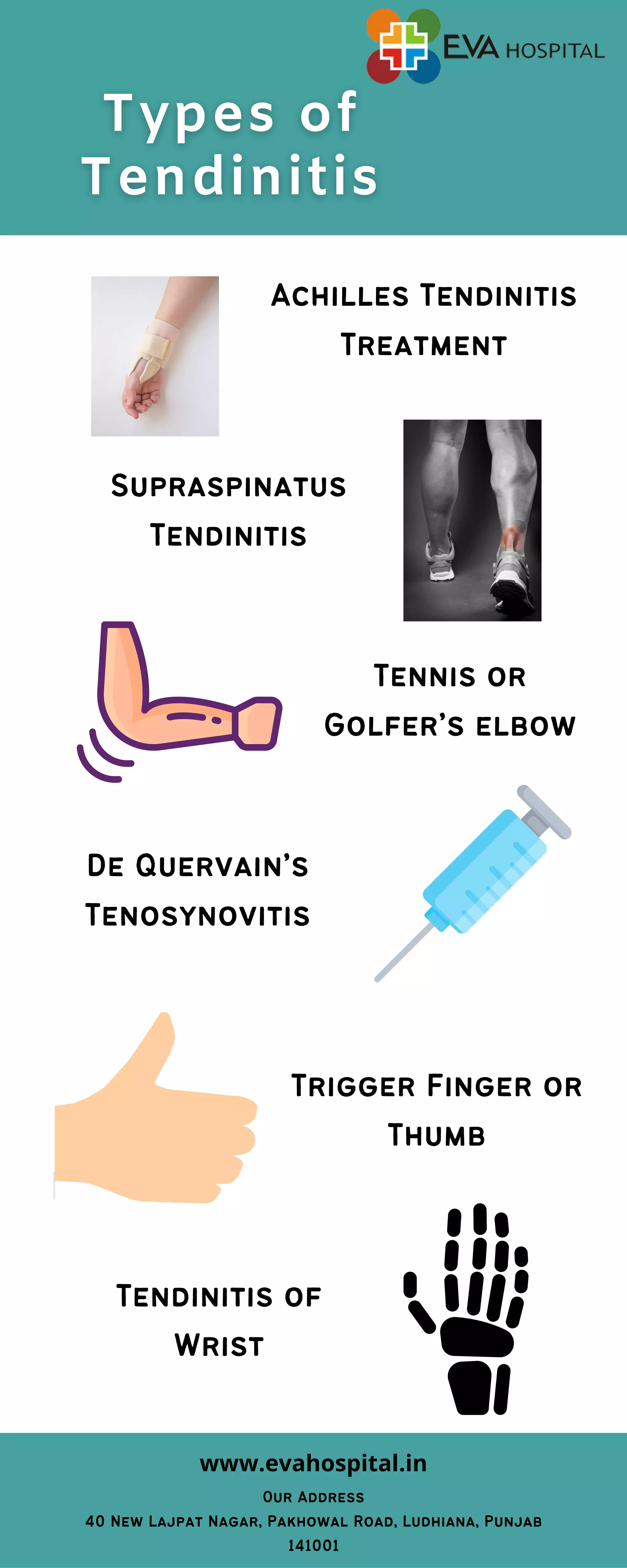 Types of Tendinitis | PDF