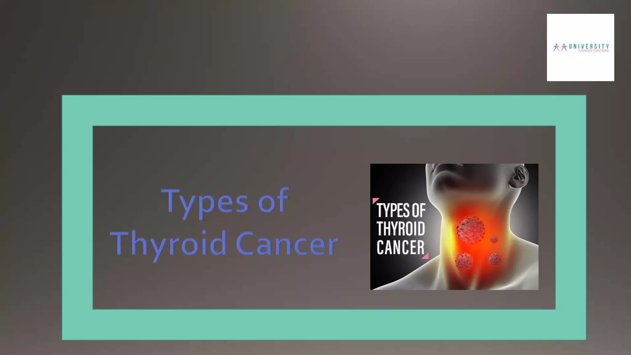 Types of Thyroid Cancer | PPTX
