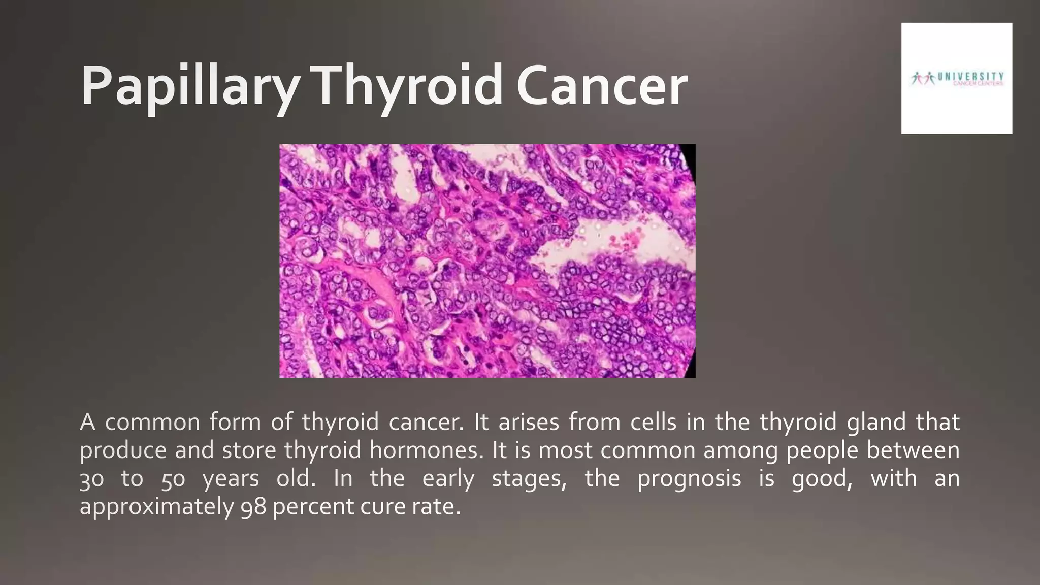 Types of Thyroid Cancer | PPTX