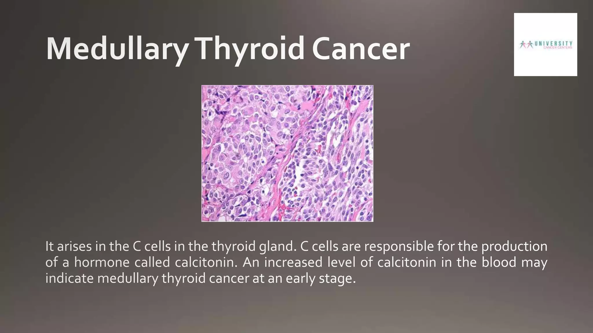 Types of Thyroid Cancer | PPTX