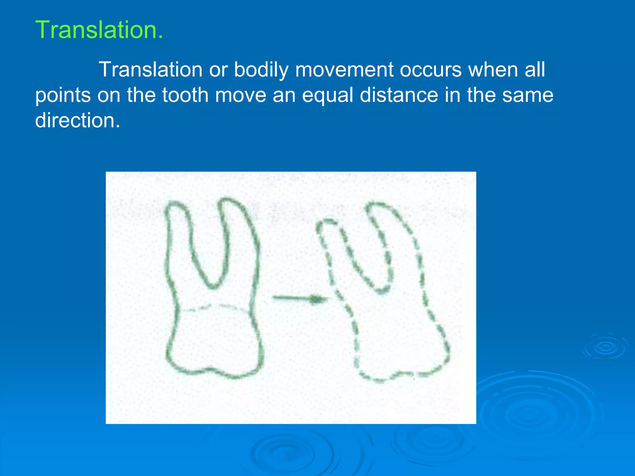 Types of tooth movement in orthodontics (4th BDS) | PPTX