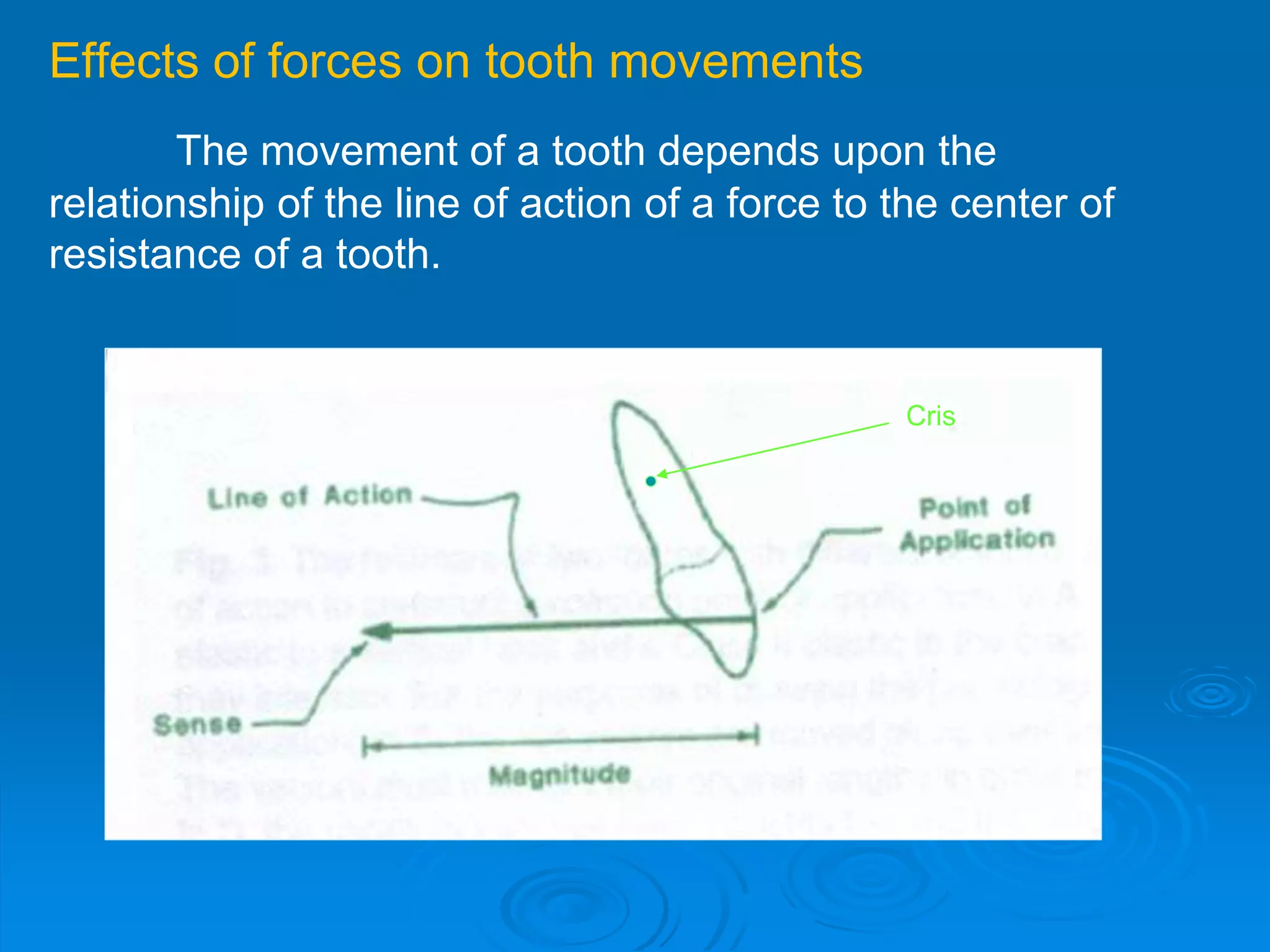 Types of tooth movement in orthodontics (4th BDS) | PPTX