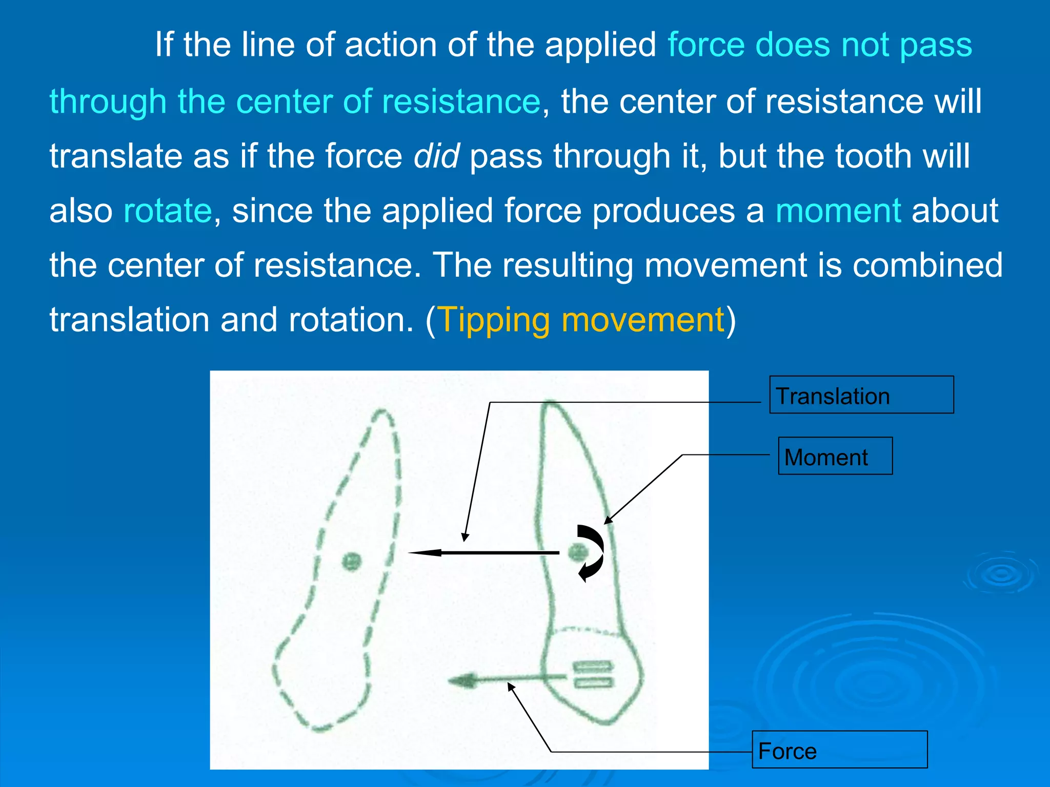 Types of tooth movement in orthodontics (4th BDS) | PPTX