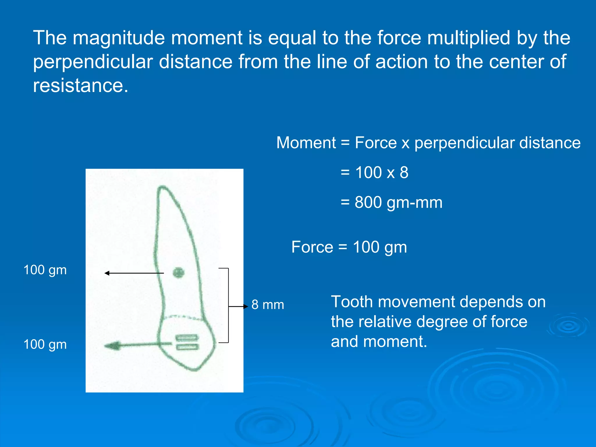 Types of tooth movement in orthodontics (4th BDS) | PPTX
