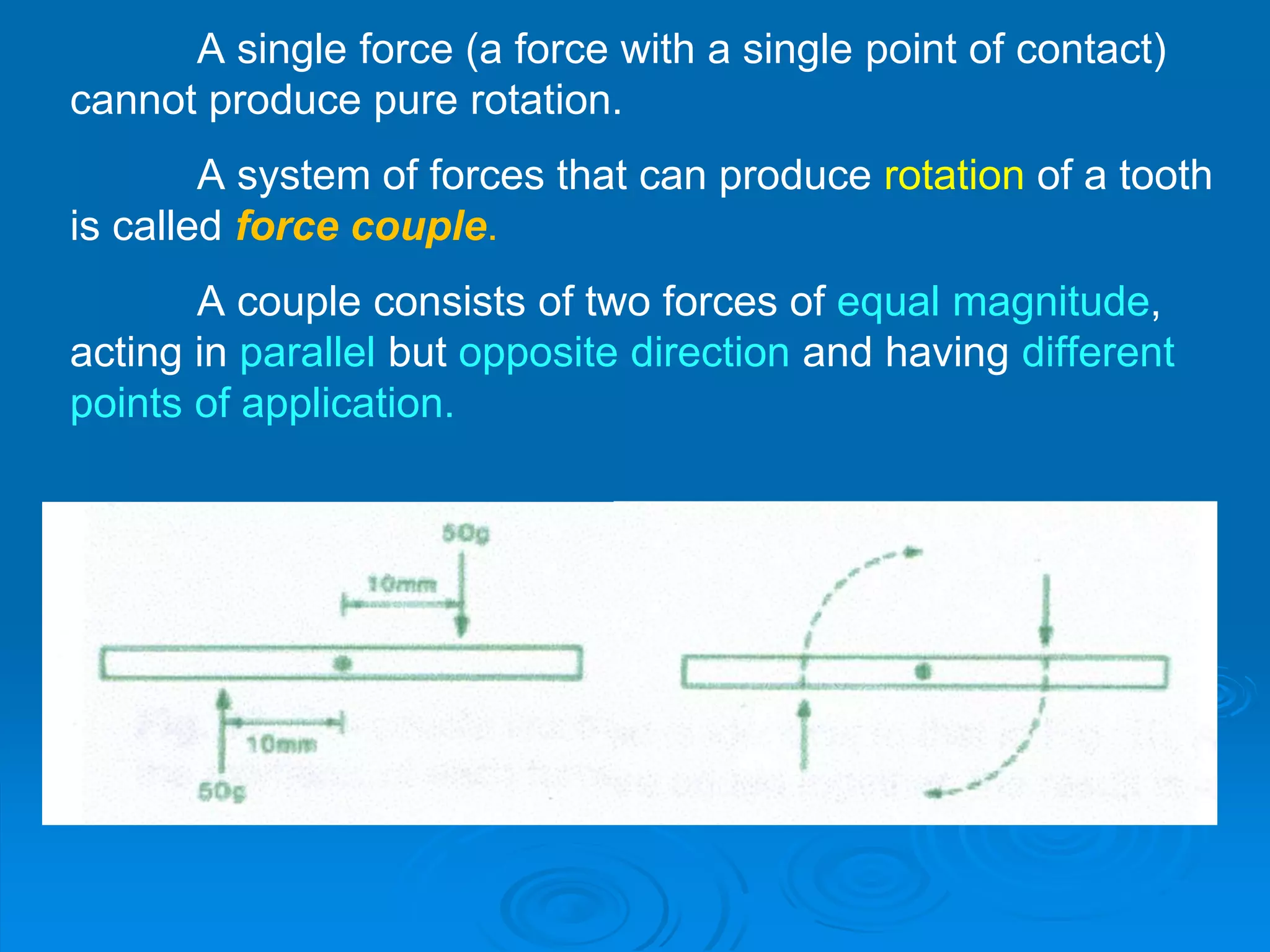 Types of tooth movement in orthodontics (4th BDS) | PPTX