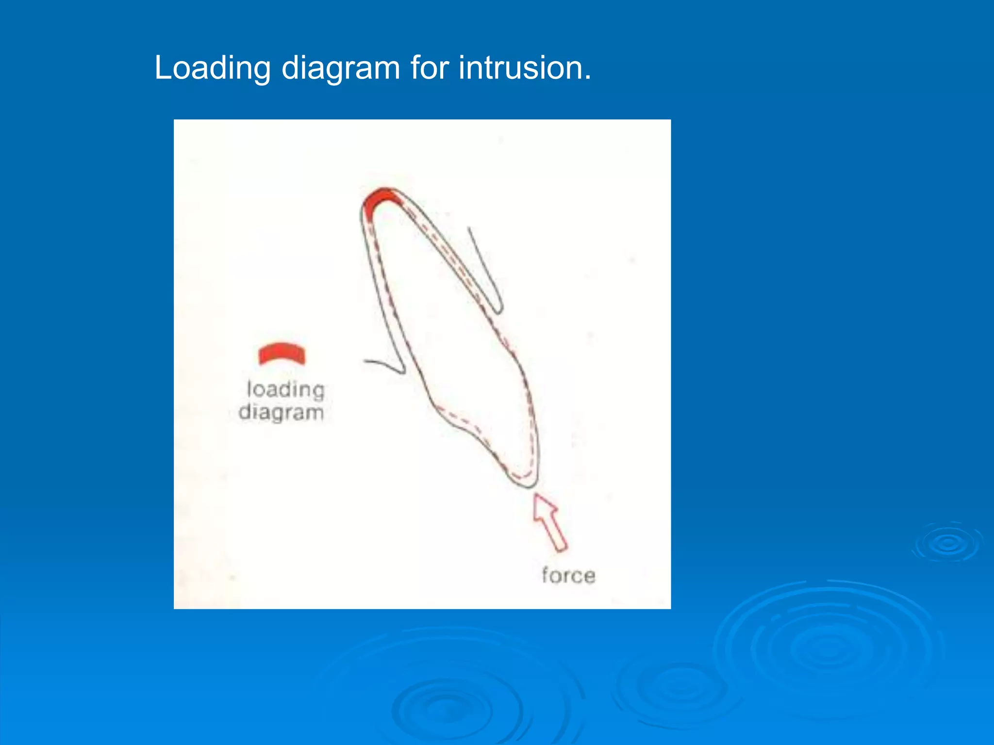 Types of tooth movement in orthodontics (4th BDS) | PPTX