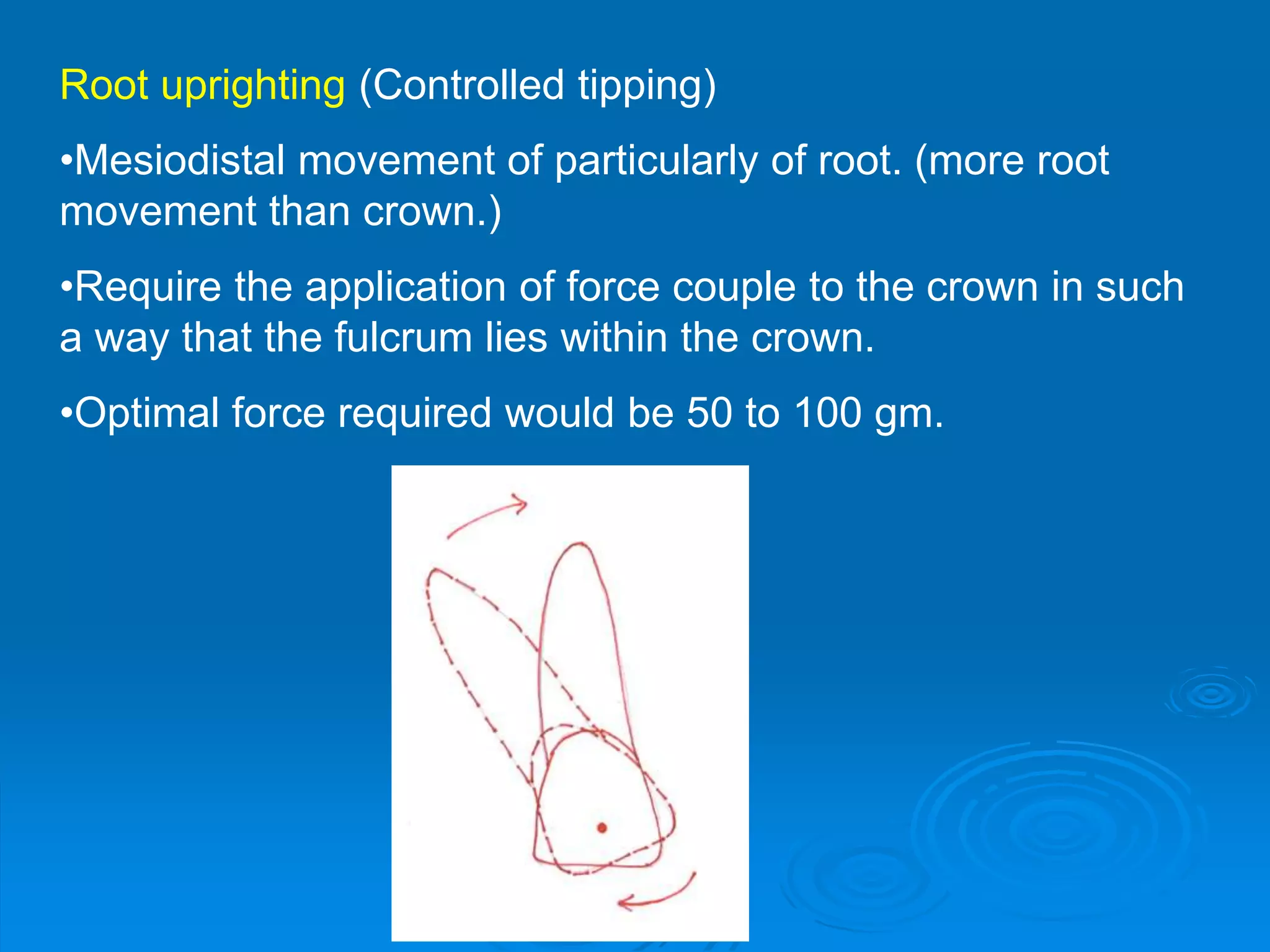 Types of tooth movement in orthodontics (4th BDS) | PPTX