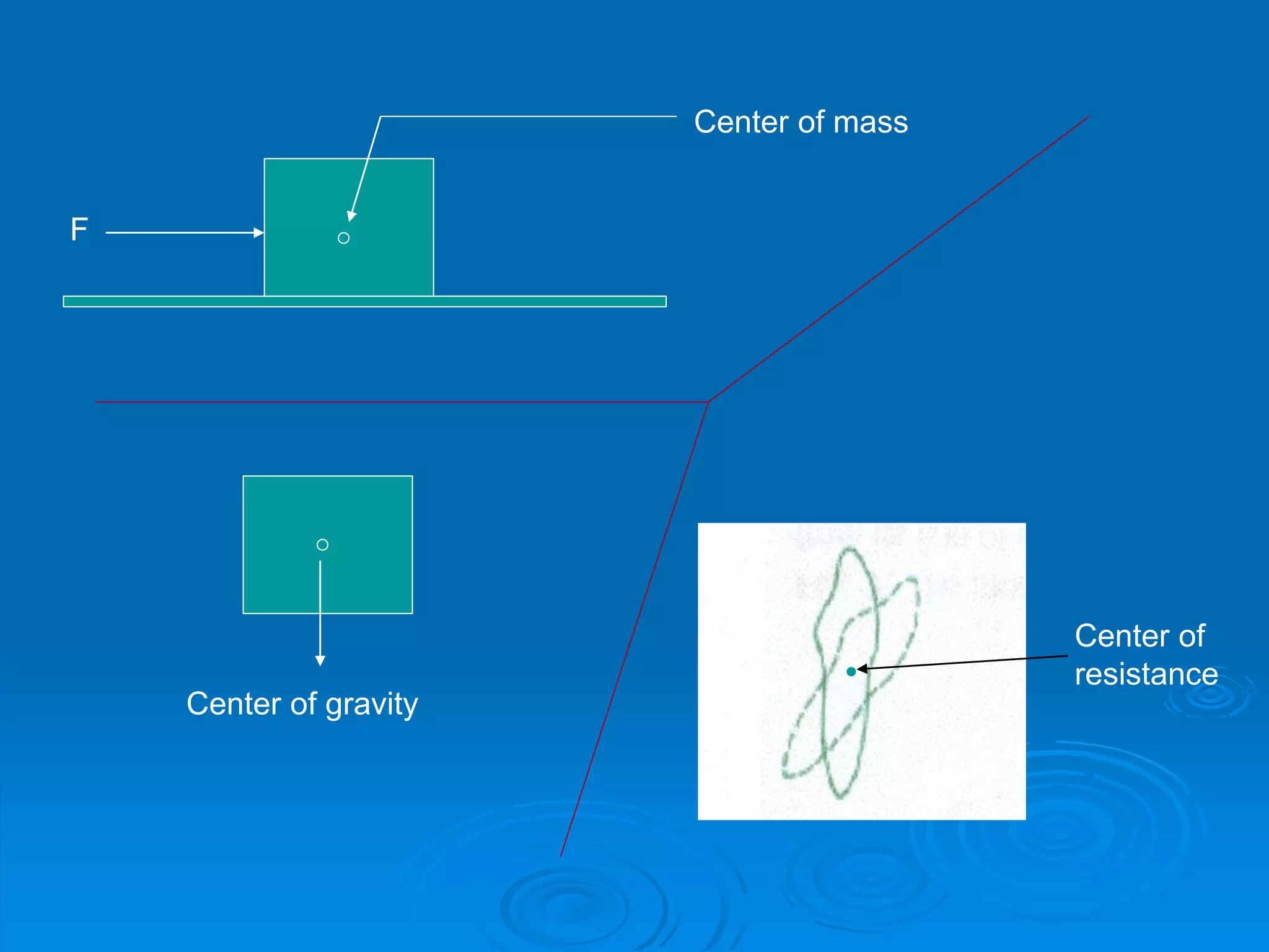 Types of tooth movement in orthodontics (4th BDS) | PPTX