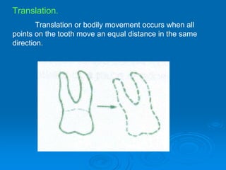 Types of tooth movement in orthodontics (4th BDS) | PPTX | Dental ...