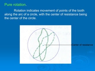 Types of tooth movement in orthodontics (4th BDS) | PPTX | Dental ...