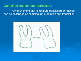 Types of tooth movement in orthodontics (4th BDS) | PPTX | Dental ...
