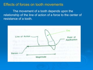 Types of tooth movement in orthodontics (4th BDS) | PPTX | Dental ...