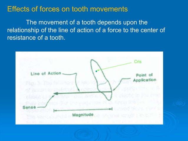 Types of tooth movement in orthodontics (4th BDS) | PPTX | Dental ...