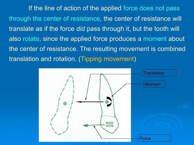 Types of tooth movement in orthodontics (4th BDS) | PPTX | Dental ...