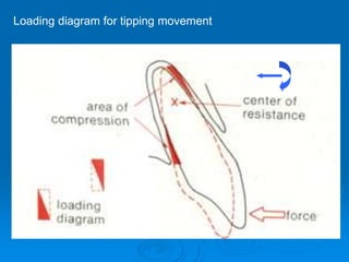 Types of tooth movement in orthodontics (4th BDS) | PPTX