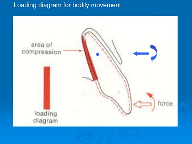 Types of tooth movement in orthodontics (4th BDS) | PPTX | Dental ...
