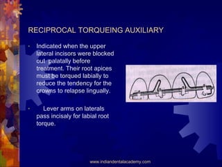 Types of torqueing auxiliary | PPT