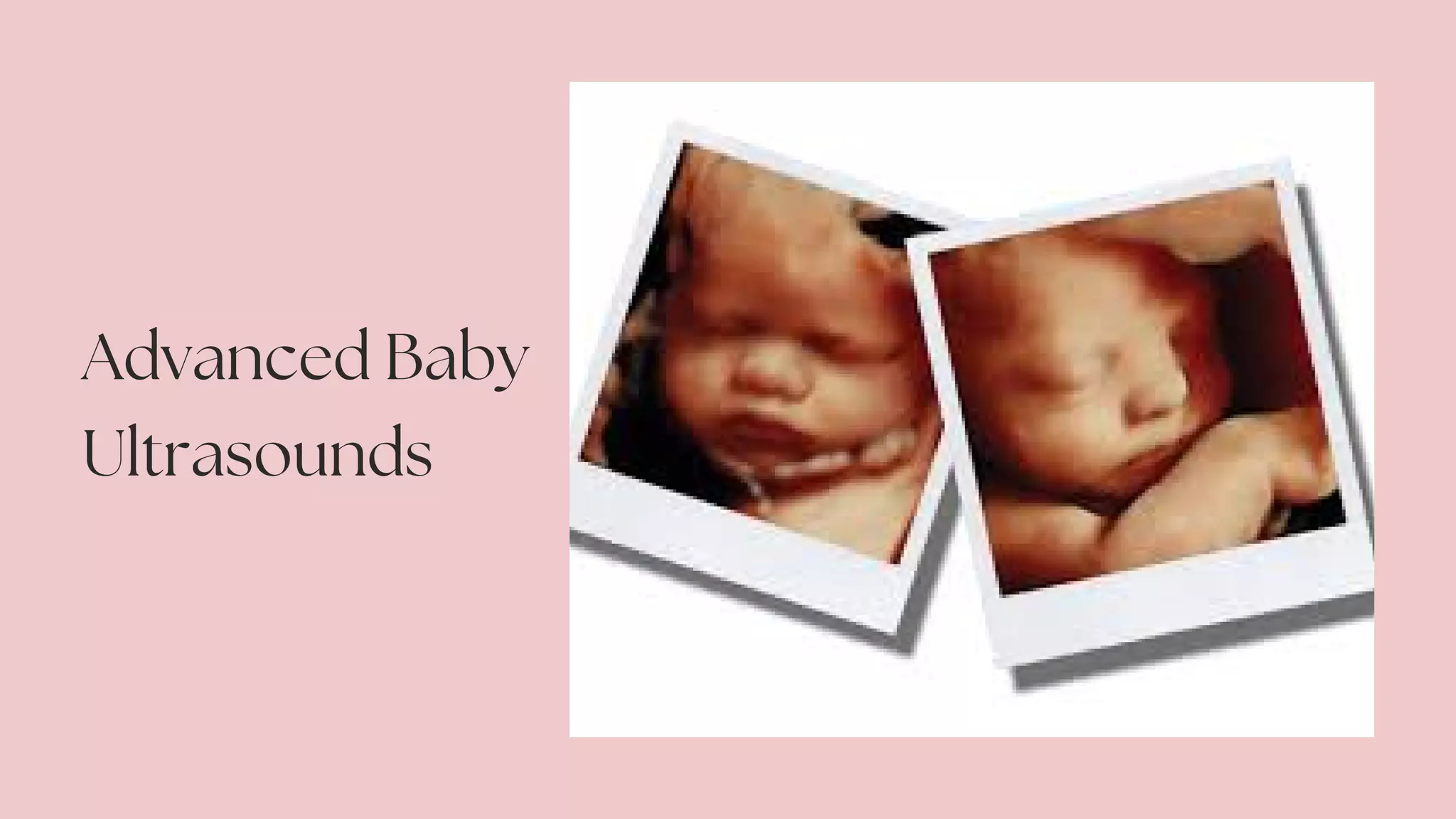 Types of Ultrasound Scan.pdf