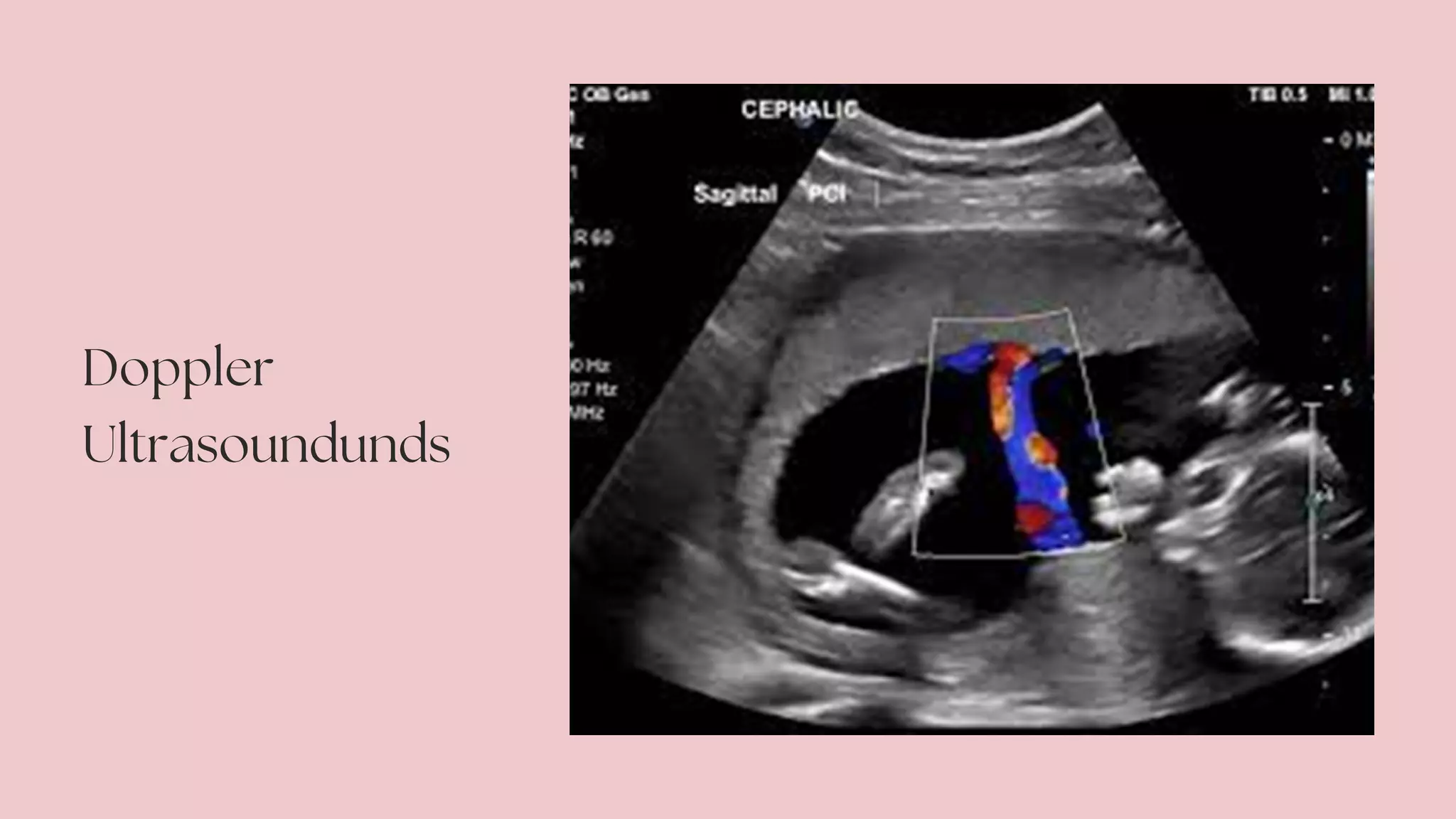 Types of Ultrasound Scan.pdf
