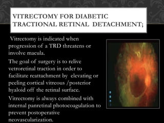 Types of vitrectomy ,indication s and complications | PPTX