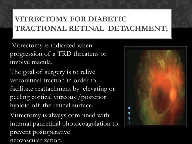 Types of vitrectomy ,indication s and complications | PPTX