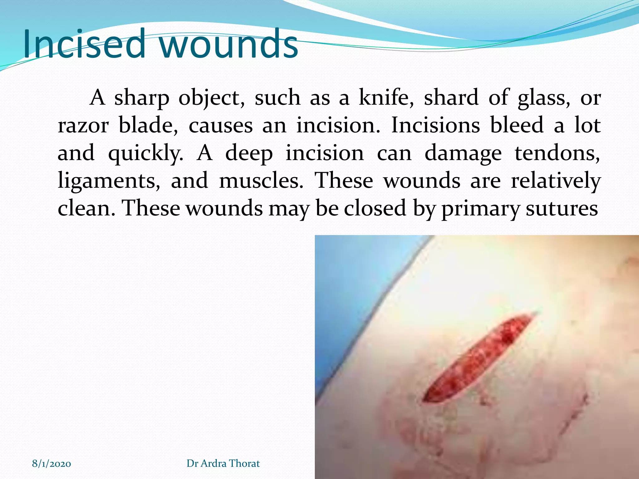 Types of wound | PPTX