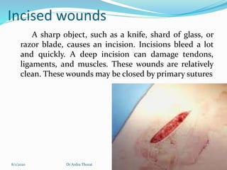 Types of wound | PPTX