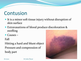 Types of wound | PPTX