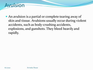 Types of wound | PPT