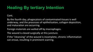 TYPES OF WOUND HEALING by Mishal Khan.pptx | Death, Injury, or Military ...