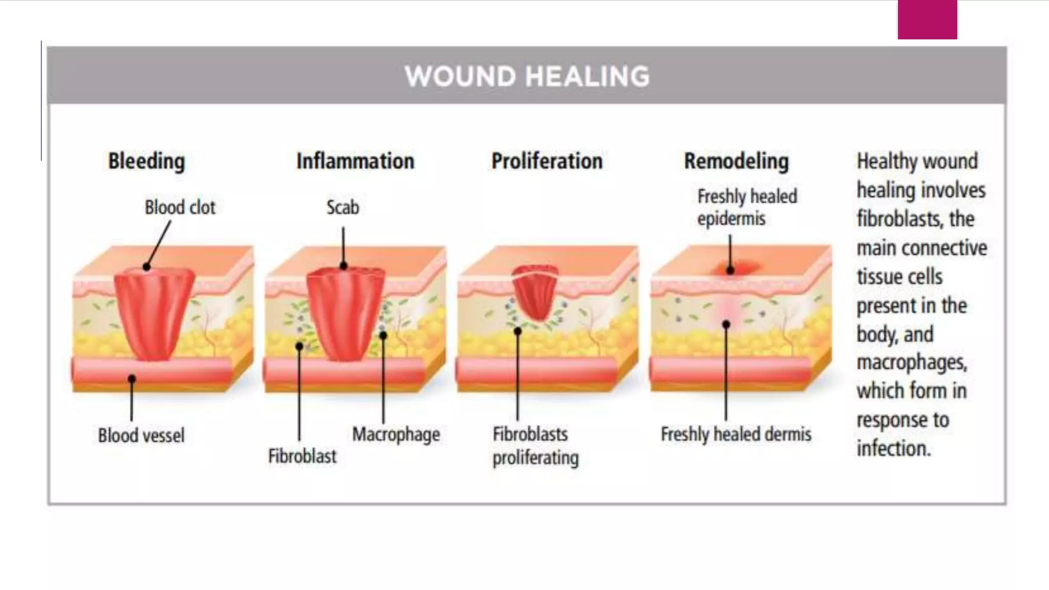 Types of wounds and management. | PPTX