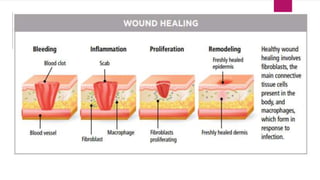 Types of wounds and management. | PPT
