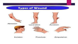 Types of wounds and management. | PPT