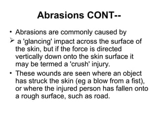 TYPES OF WOUNDS IN FORENSIC MEDICINE I-2.ppt