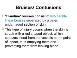 TYPES OF WOUNDS IN FORENSIC MEDICINE I-2.ppt