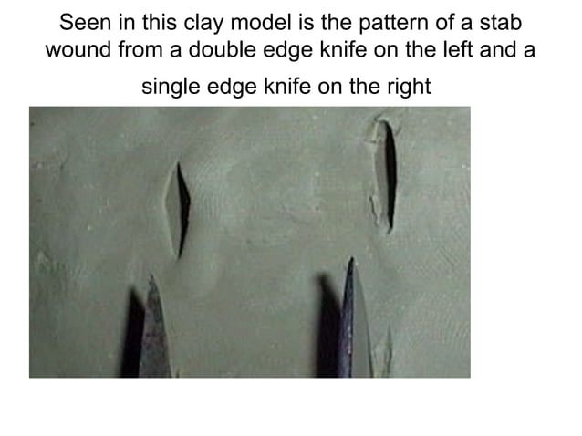 TYPES OF WOUNDS IN FORENSIC MEDICINE I-2.ppt