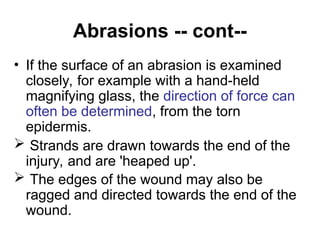 TYPES OF WOUNDS IN FORENSIC MEDICINE I-2.ppt
