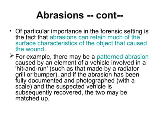 TYPES OF WOUNDS IN FORENSIC MEDICINE I-2.ppt