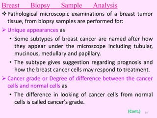Types & Sub-types of Breast Cancer | PPTX