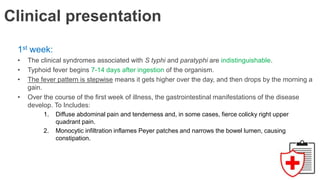 Typhoid Fever - Enteric Fever | PPTX