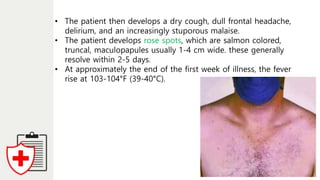 Typhoid Fever - Enteric Fever | PPTX