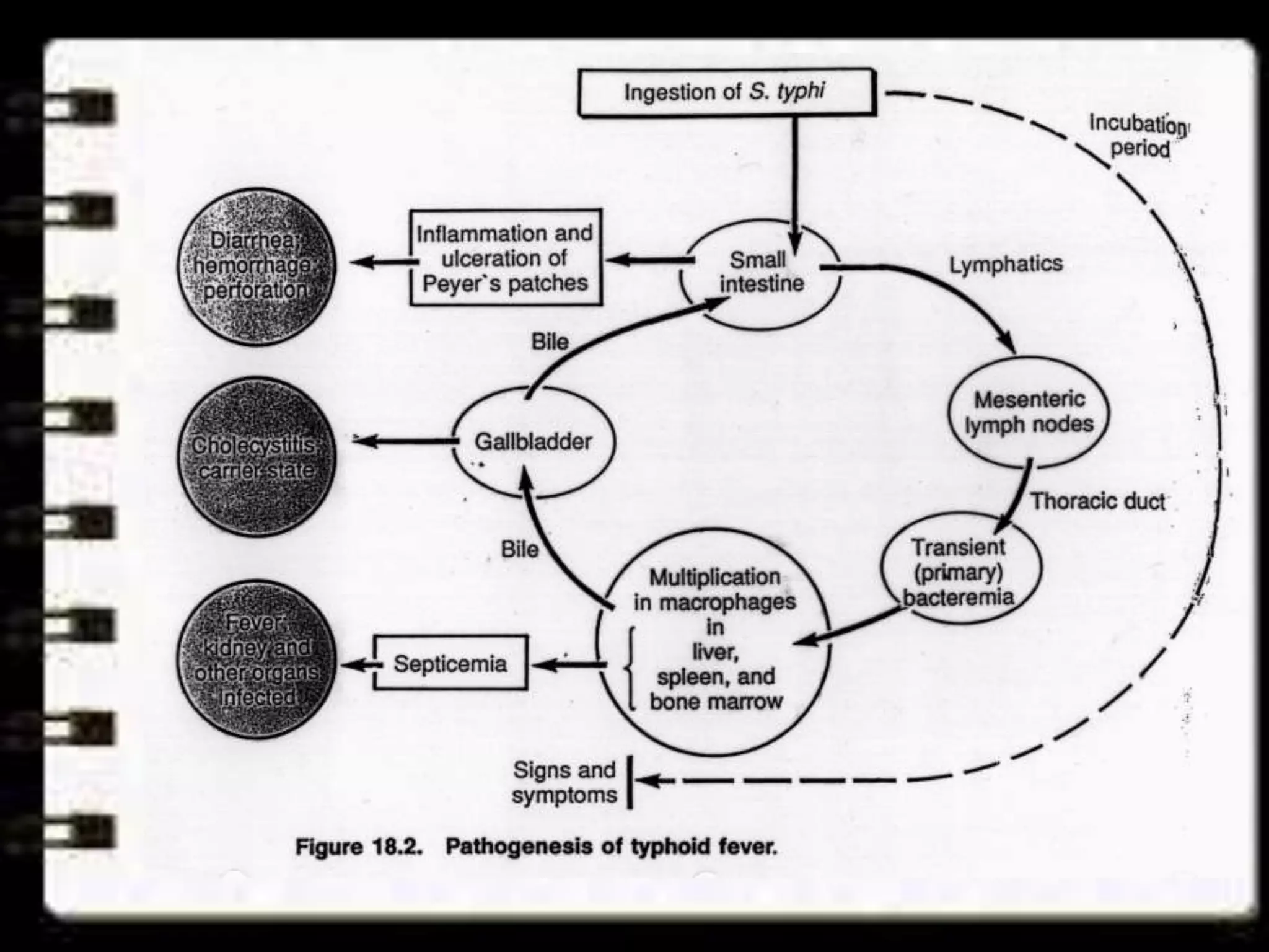 Typhoid | PPTX