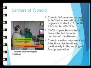 Typhoid | PPTX