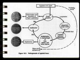 Typhoid | PPTX